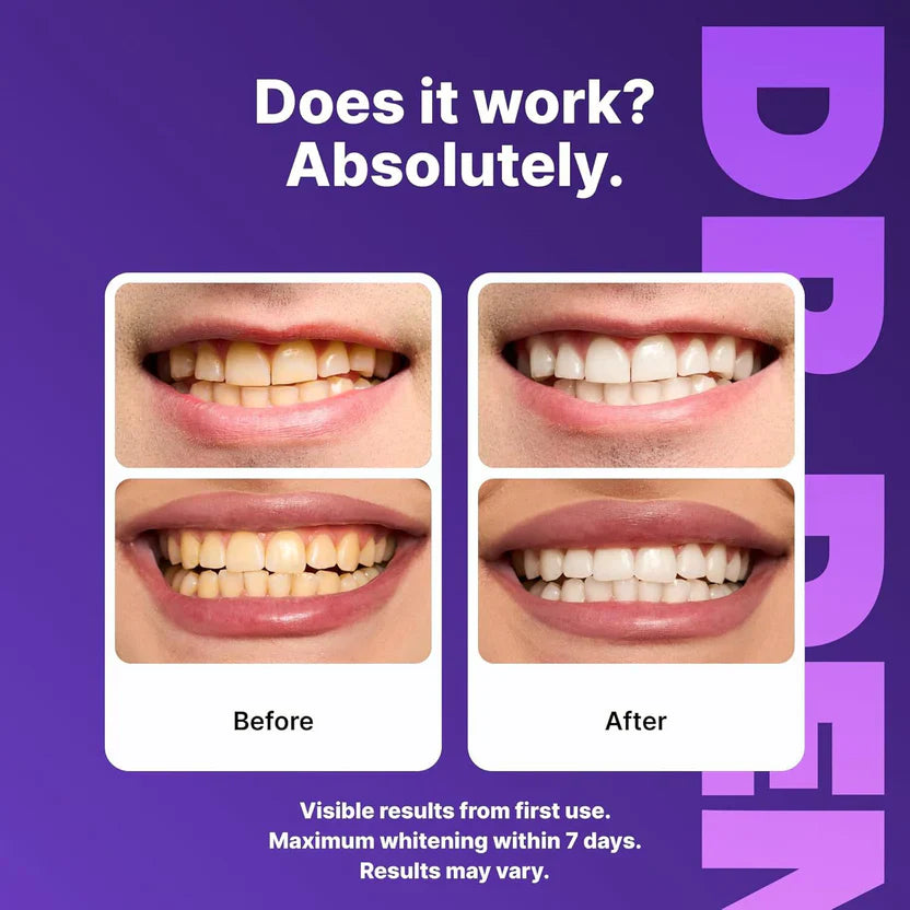 Purple Instant Teeth Whitening Strips – Prime Land